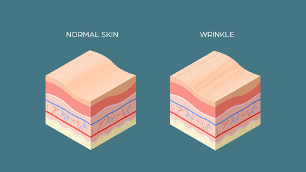 Wrinkle and normal skin cross-section human Vector Image