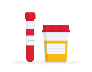 Urine color chart in test tubes medical Royalty Free Vector