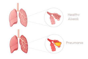 Human lungs with alveoli cartoon design Royalty Free Vector