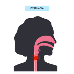 Dysphagia medical poster Royalty Free Vector Image