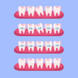 Braces Cartoon Vector Images (over 1,800)