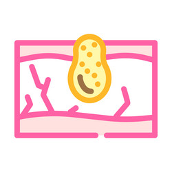 Body Acne Vector Images (over 3,100)