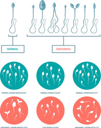 Spermogram Vector Images (over 110)
