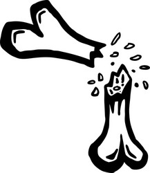 Broken bone Royalty Free Vector Image - VectorStock