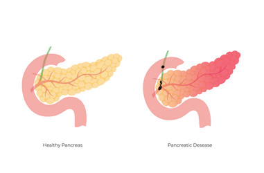 Pancreas Vector Images (over 5,600)