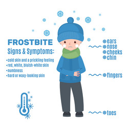 Frostbite infographic in cartoon style isolated Vector Image
