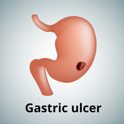 Realistic human sick small intestine isolated Vector Image