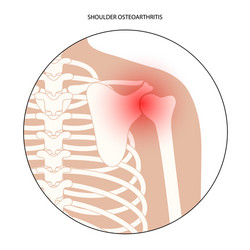 Shoulder Logo Vector Images (over 2,200)