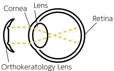 How do vision correction lenses Royalty Free Vector Image