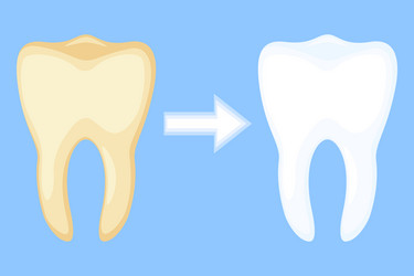 Perfect Dent Vector Images (61)