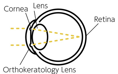 How do vision correction lenses Royalty Free Vector Image