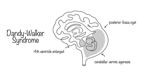 Hyperlexia Royalty Free Vector Image - VectorStock