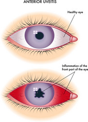 Eye Floater Vector Images (20)
