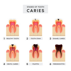Caries Vector Images (over 17,000)