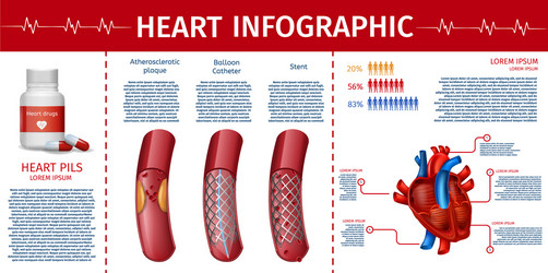 Cardiovascular Vector Images (over 10,000)