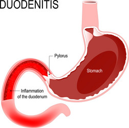 Stomach sections diagram Royalty Free Vector Image
