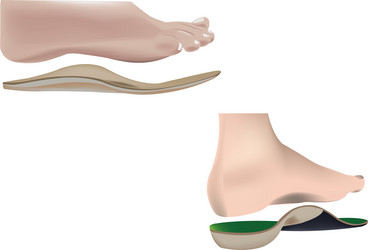 Human feet with use of insoles Royalty Free Vector Image