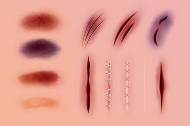Bruising Vector Images (over 2,000)