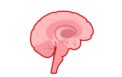 Meningitis medical poster Royalty Free Vector Image