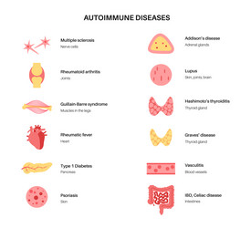 Autoimmune disease infographic Royalty Free Vector Image
