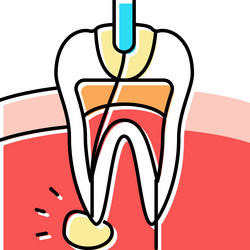 Root Canal Treatment Vector Images (over 420)