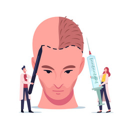 Women hair problem infographics female with bald Vector Image