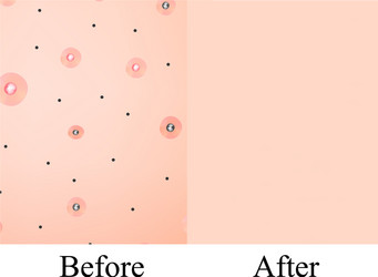 Skin texture with black dots acne before after Vector Image