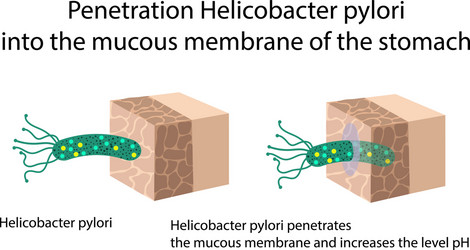 Stomach and bacteria helicobacter pylori Vector Image