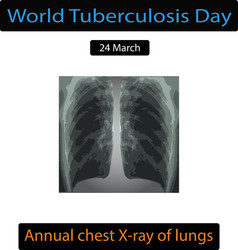 X-rays of light diagnosis tuberculosis Royalty Free Vector