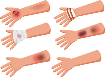 Bandage human body injury bandaging parts Vector Image
