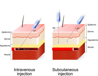 Intravenous Injection Vector Images (over 3,300)