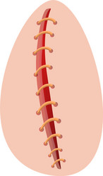 Wound suture icon cartoon style Royalty Free Vector Image