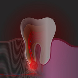 Cause and Effect Diagram Vector Images (24)