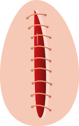 Laceration suture icon cartoon style Royalty Free Vector