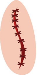 Incision suture icon cartoon style Royalty Free Vector Image