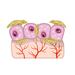 Subcutaneous Acne Vector Images (37)