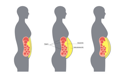 Visceral Fat Anatomy Diagram Royalty Free Vector Image