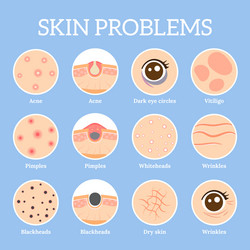 Woman facial skin problems skin care infographic Vector Image