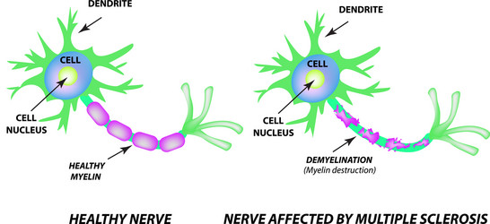 Axon Vector Images (over 1,700)