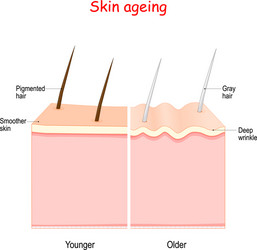 Aging process comparison of young and aged skin Vector Image