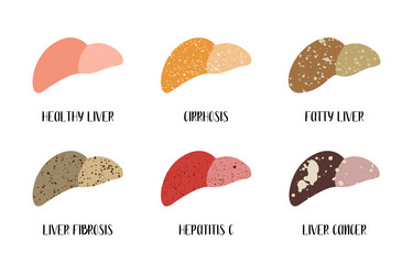 Healthy liver and various liver diseases Vector Image