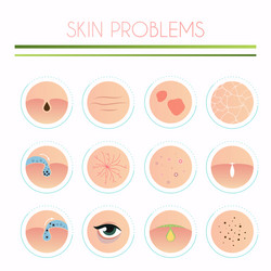 Woman facial skin problems care infographic Vector Image