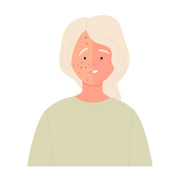 Acne Vector Images within People (over 1,800)