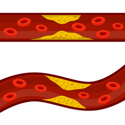 Platelets Vector Images (over 1,800)