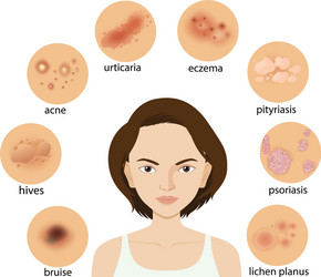 Diagram showing different human skin conditions Vector Image