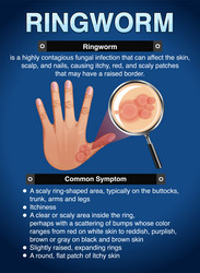 Ringworm Vector Images (over 240)