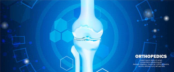 Medical orthopedic knee bone Royalty Free Vector Image