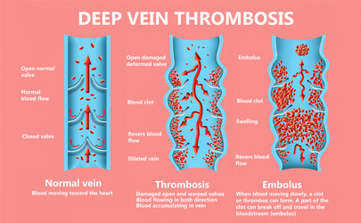 Dvt Vector Images (78)