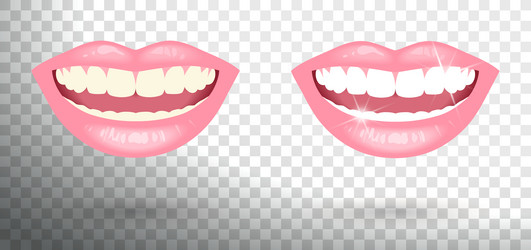 Smile with White Teeth Vector Images (over 18,000)
