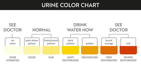 Urine color chart Royalty Free Vector Image - VectorStock
